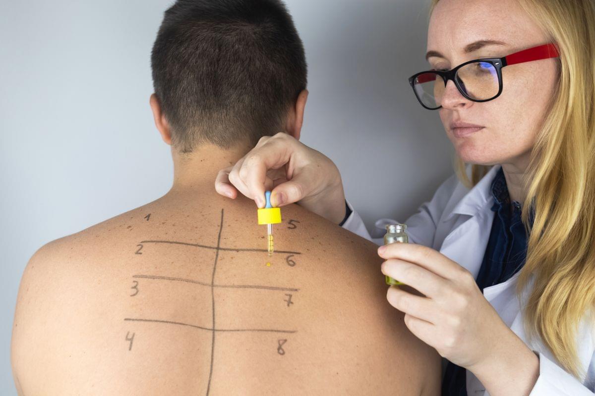 Como funciona o prick teste para alergias? - Brasil123